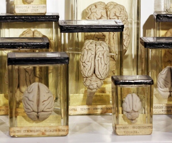 Research With Monkey Brains Provides Hope for Stroke Victims | Newsmax.com