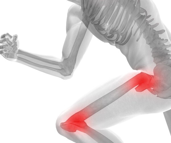 Amgen Bone Drug Shows Promise in Trial | Newsmax.com