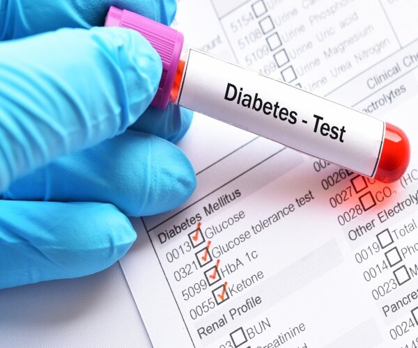Expert Panel Lowers Routine Screening Age for Diabetes to 35 | Newsmax.com