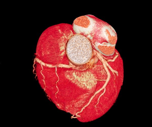 New High-Res Heart Imaging More Accurate | Newsmax.com