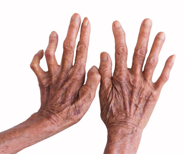 CDC Issues Leprosy Warning | Newsmax.com