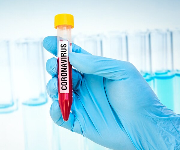 Report: Problems With CDC Coronavirus Test Delays Expanded U.S ...