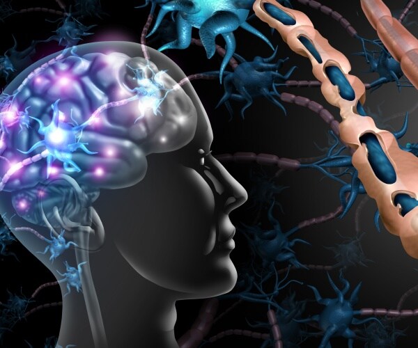 FDA Declines to Approve Multiple Sclerosis Injection | Newsmax.com