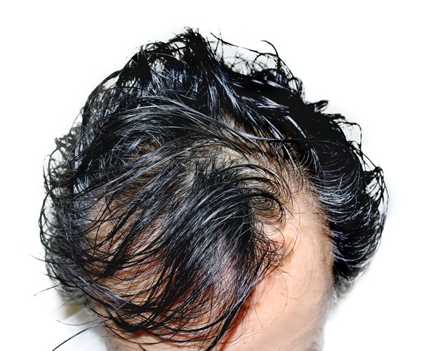 Hair Club for Men Founder and Client - Sy Sperling Dies | Newsmax.com