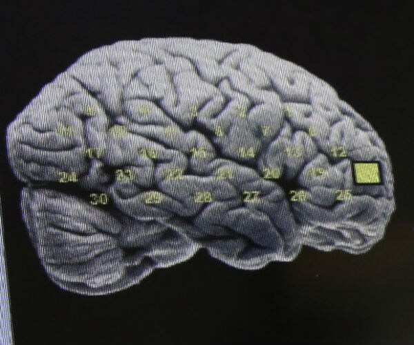 Report: Scientists 'Hacked' Brain, Controlled Body | Newsmax.com