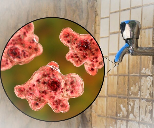 Boy, 6, Dies of Brain-Eating Bacteria in Houston Area | Newsmax.com