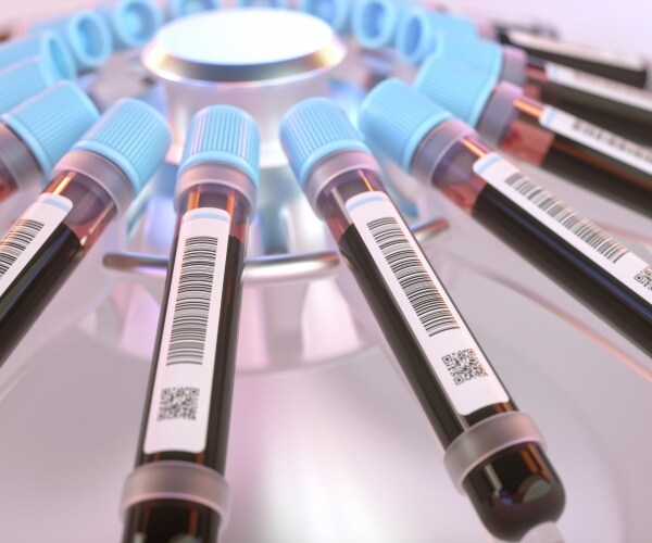 Blood Test Measures ALS Risk From Toxin Exposure | Newsmax.com