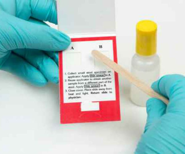 Study: At-Home Test a Good Alternative to Colonoscopy | Newsmax.com