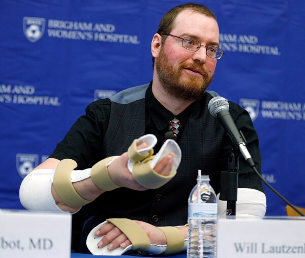 Double Arm Transplant Feels 'Surreal' to Quadruple Amputee | Newsmax.com