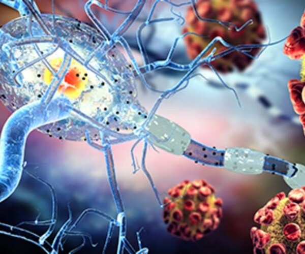 New MS Drug Beats Common Treatment in Trial | Newsmax.com