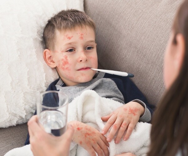 Measles Deaths Worldwide Rose 40 Percent Last Year | Newsmax.com